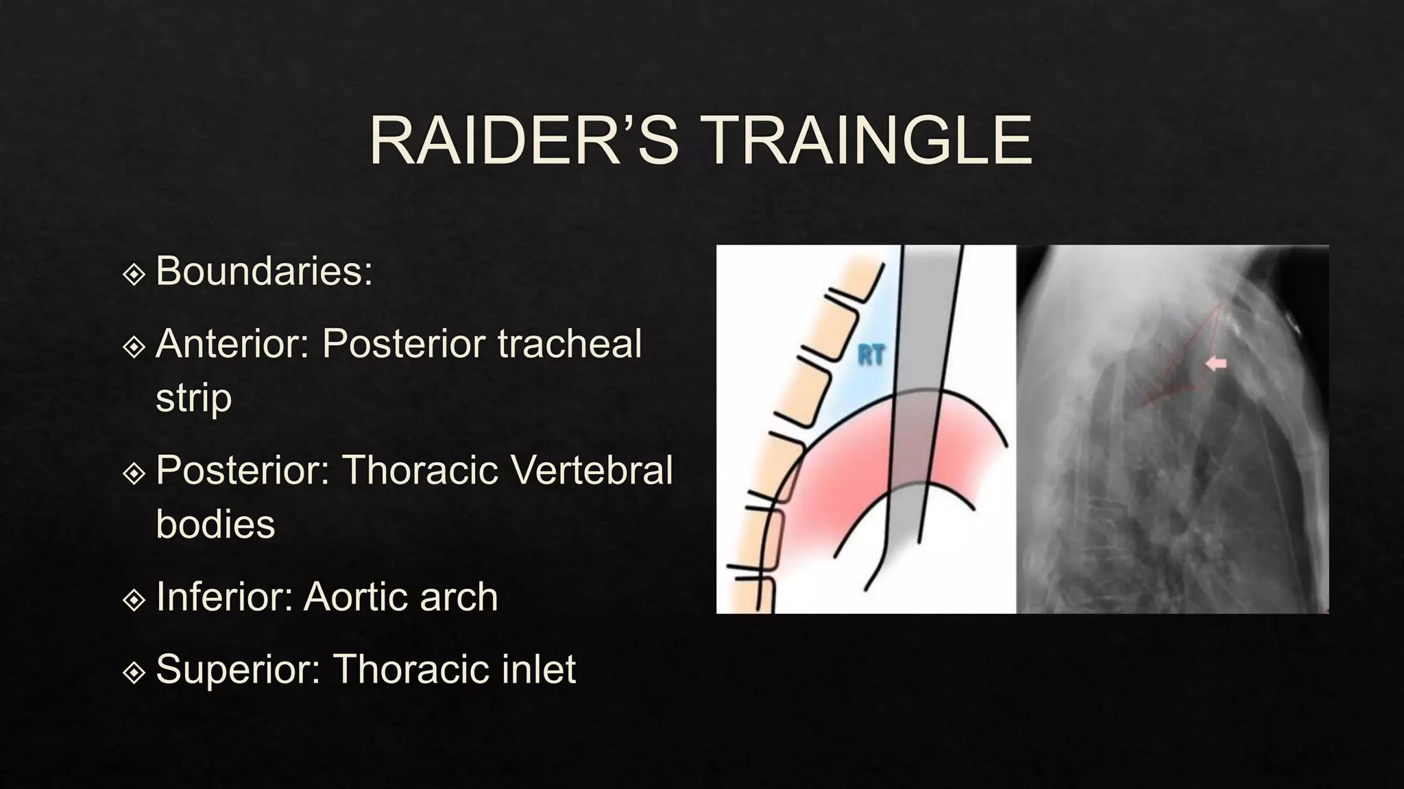 Lateral chest X-Ray.pptx