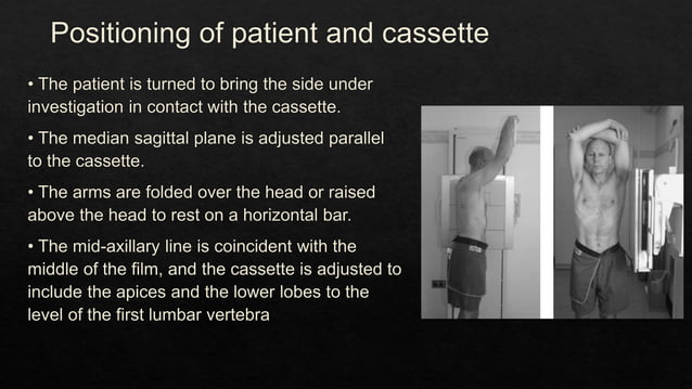 Lateral chest X-Ray.pptx | Death, Injury, or Military Conflict ...