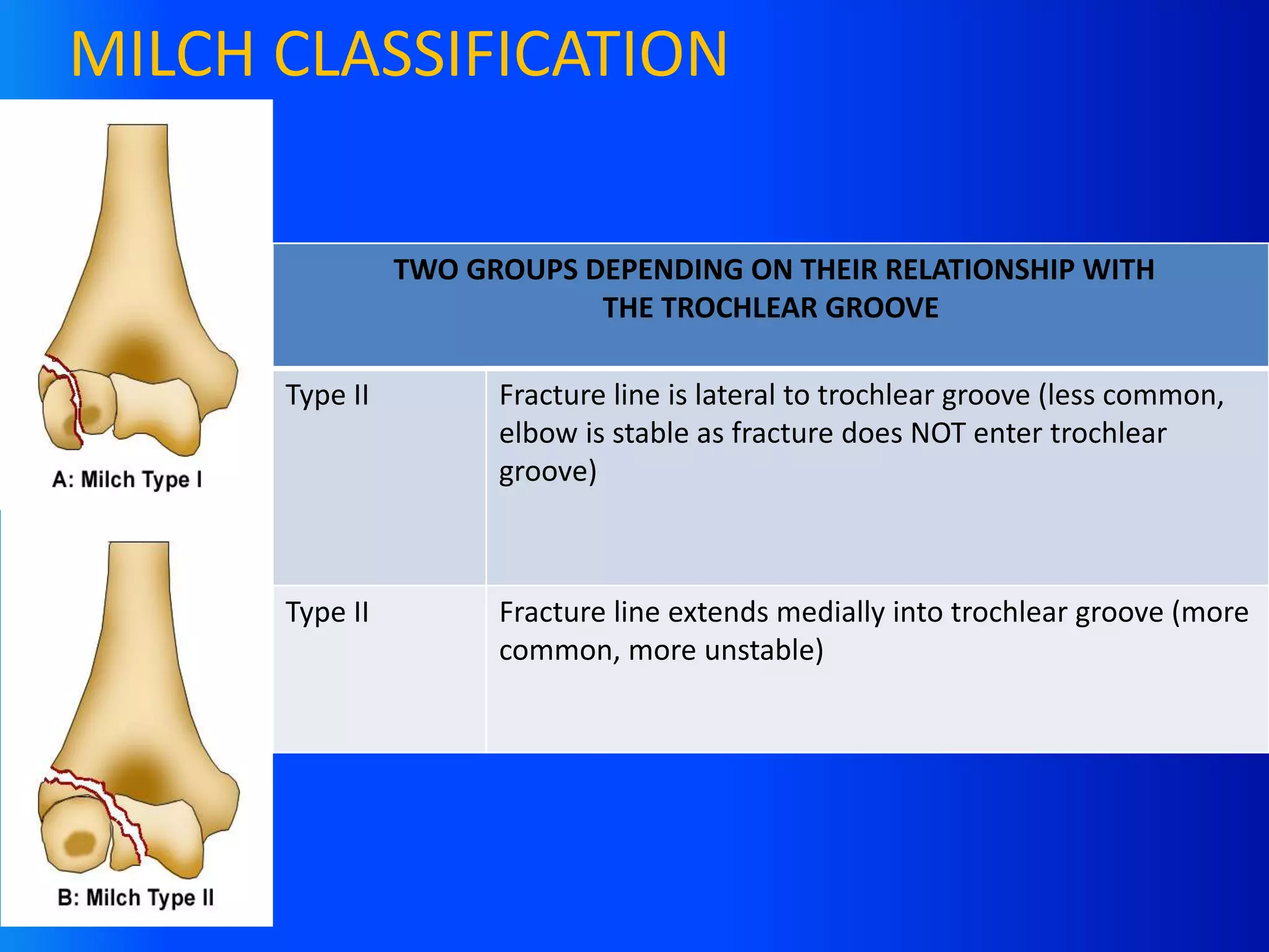 Lateral condyle.pptx