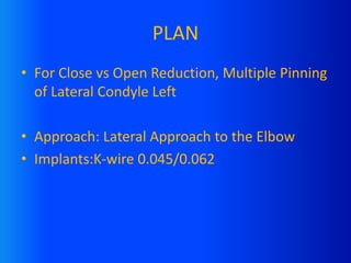 Lateral condyle.pptx