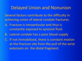 Lateral condyle.pptx