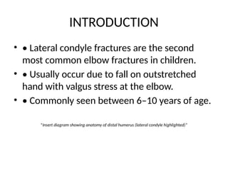 Lateral_Condyle_Fractures_Maheshwari.pptx