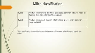 Lateral condyle of humerus fracture in children | PPTX