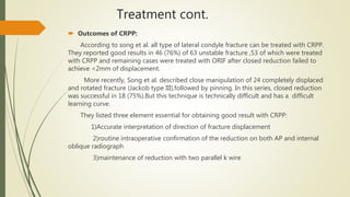 Lateral condyle of humerus fracture in children | PPTX