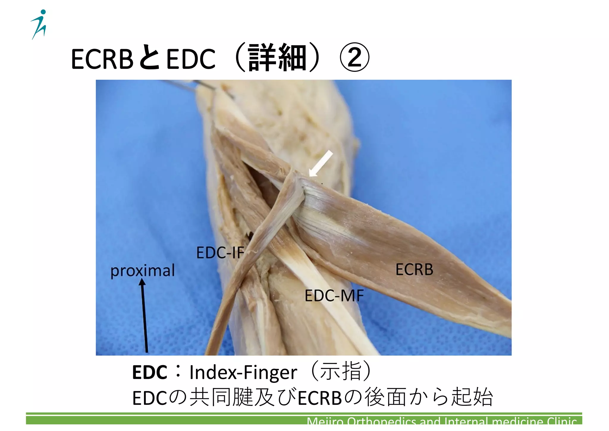 肘外側上顆炎(テニス肘) 治療など文献まとめ Lateral epicondylitis | PDF