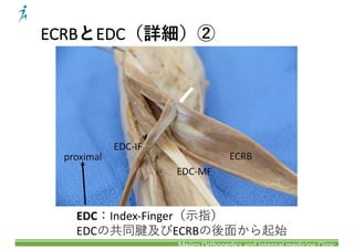 肘外側上顆炎(テニス肘) 治療など文献まとめ Lateral epicondylitis | PDF