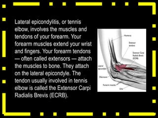Lateral Epicondylitis | PPTX