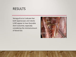 lateral lymph node dissection.pptx | Cancer | Diseases and Conditions