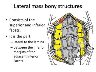 Lateral mass screws | PPSX