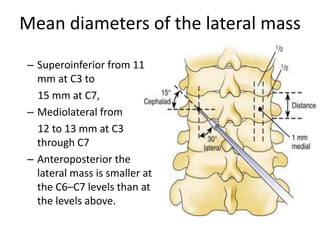 Lateral mass screws | PPSX
