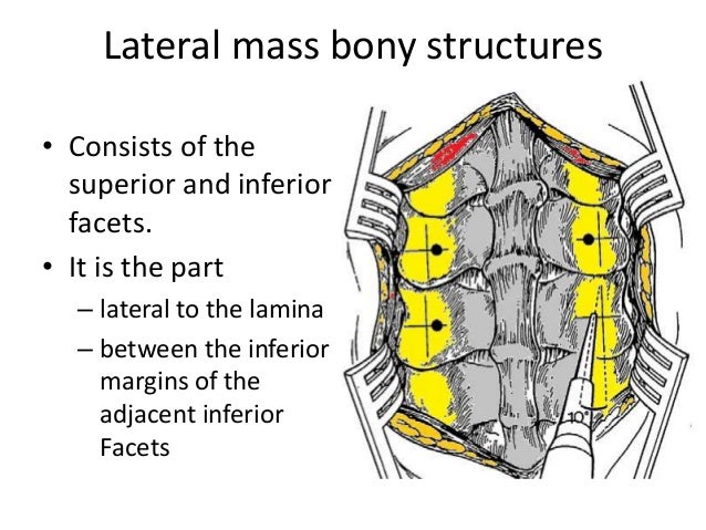 Lateral mass screws