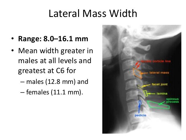 Lateral Mass Screws