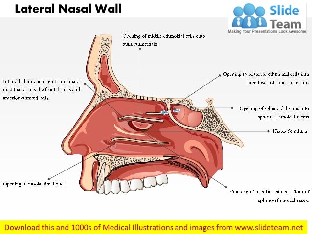 Lateral nasal wall medical images for power point
