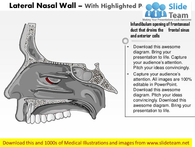 Frontonasal Duct