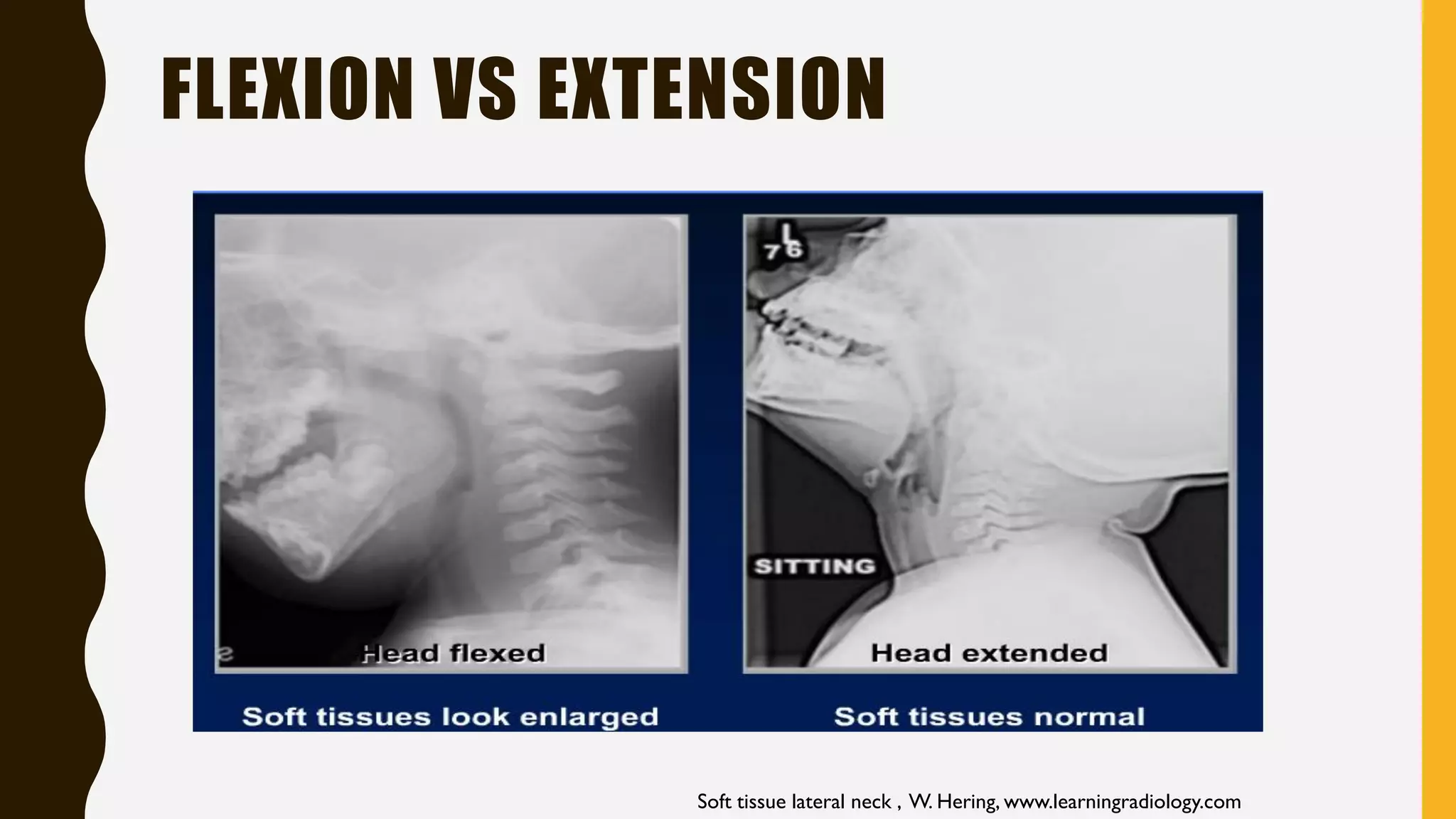Lateral neck radiographs | PDF