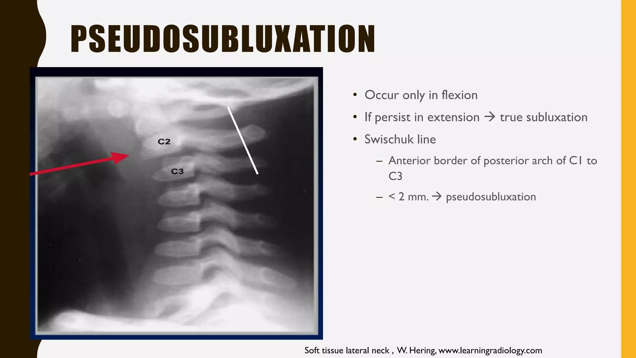 Lateral neck radiographs | PDF