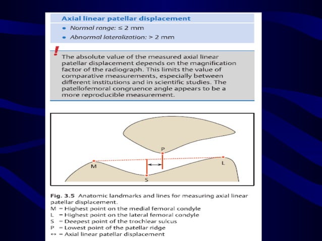 Lateral patellar compression syndrome | PPT