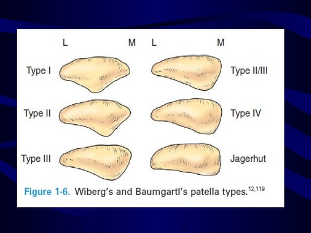 Lateral patellar compression syndrome | PPT