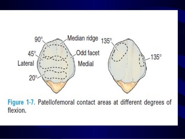 Lateral patellar compression syndrome