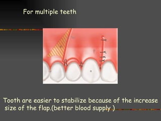 Lateral pedical graft | PPT