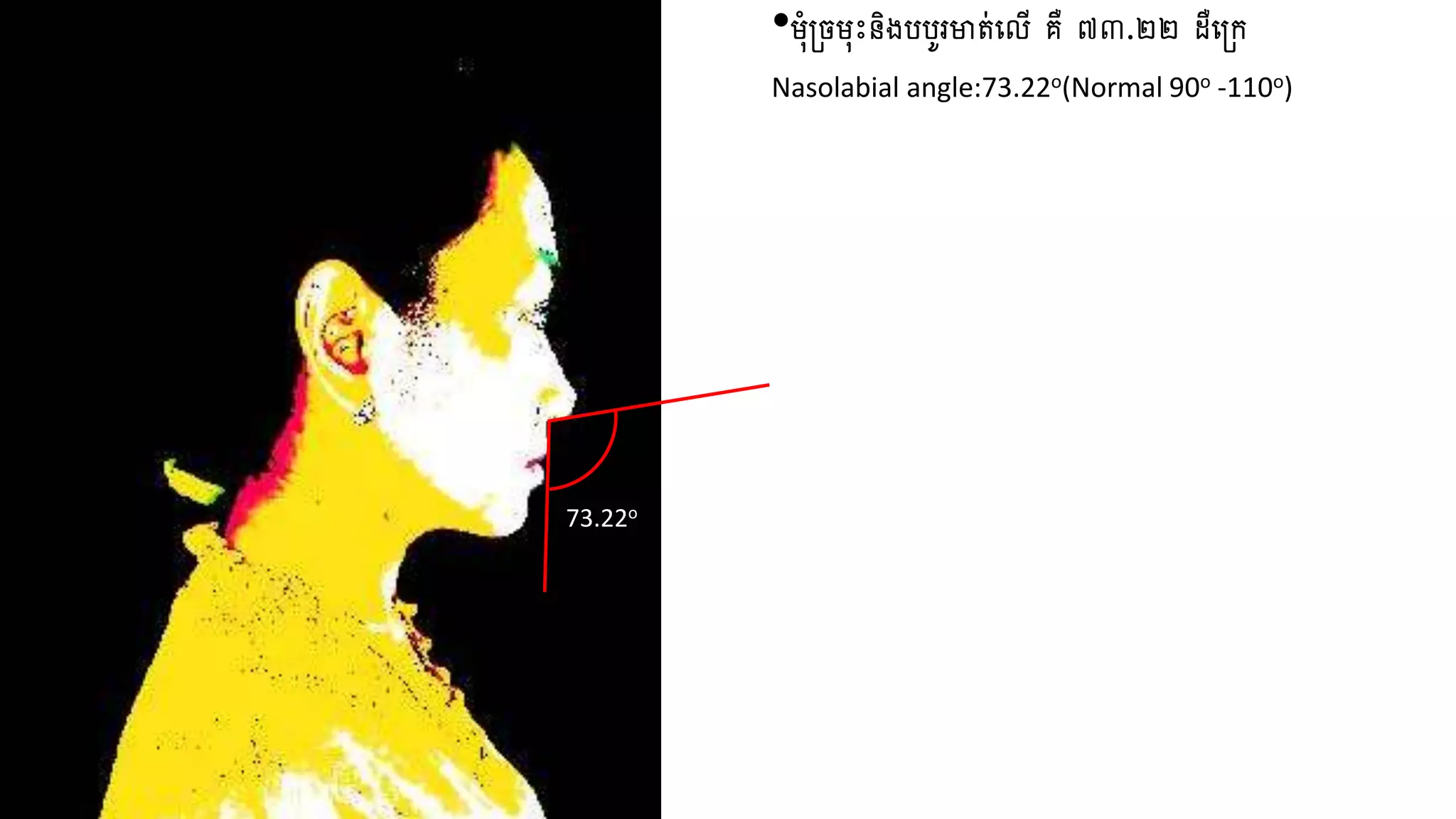 Lateral profile measurement | PPT | Free Download