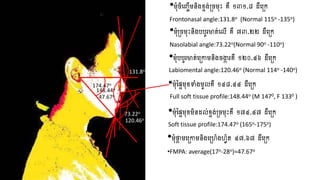 Lateral profile measurement | PPT