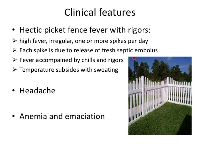 Lateral sinus thrombophlebitis