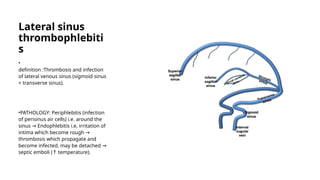 Lateral sinus thrombophlebitis as a complication ent.pptx