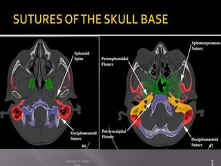 Lateral skull base anatomy and applied science by Dr, bomkar bam | PPTX