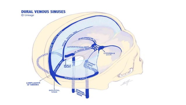 lateral venous sinus.pptx