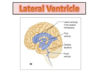 Lateral Ventricle Model