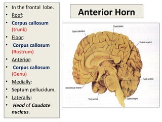 The Anterior Horn Of Lateral Ventrical