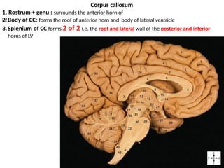 lateral ventricle neuroanatomy lecture.pptx