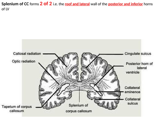 lateral ventricle neuroanatomy lecture.pptx