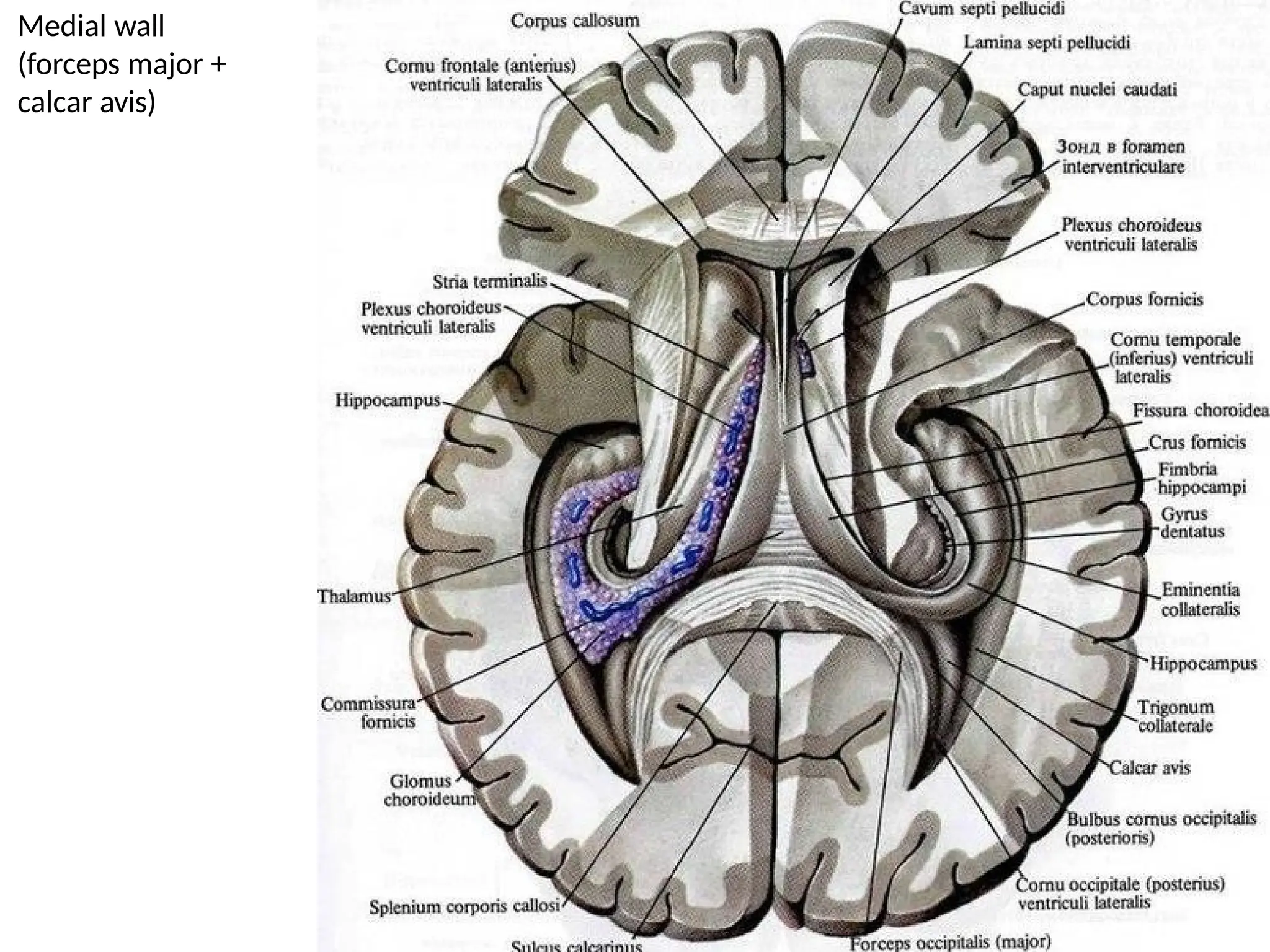lateral ventricle lecture power point .. | PPTX
