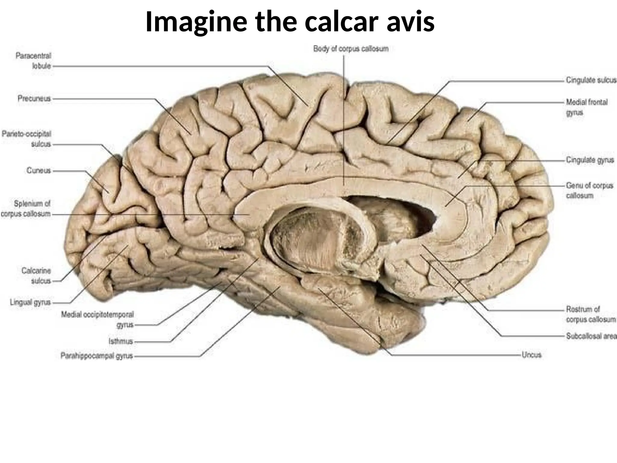 lateral ventricle lecture power point .. | PPTX