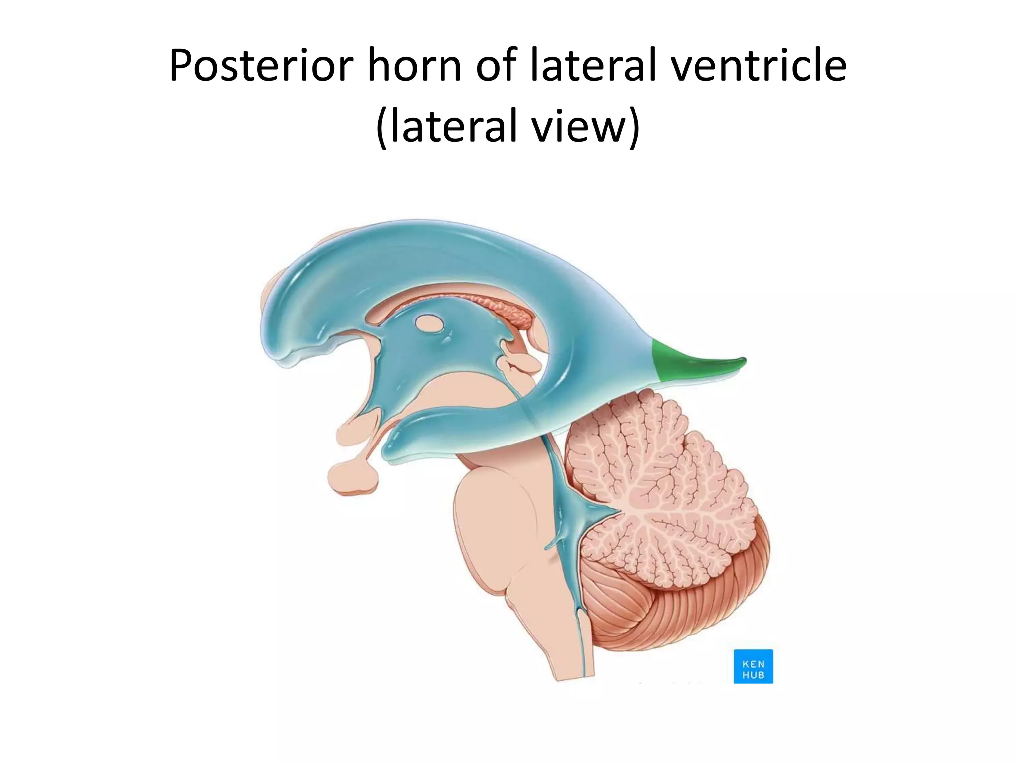 Lateral ventricle - Dr.K.S.Ravi