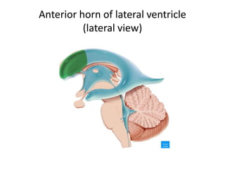 Lateral ventricle - Dr.K.S.Ravi