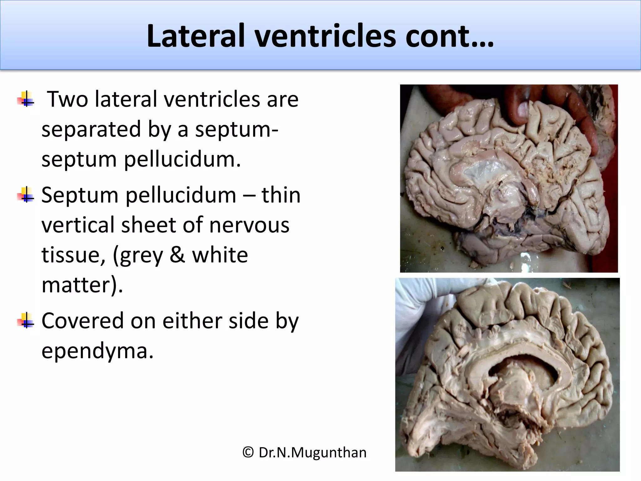 Lateral ventricle of Brain. By Dr.N.Mugunthan.M.S | PDF