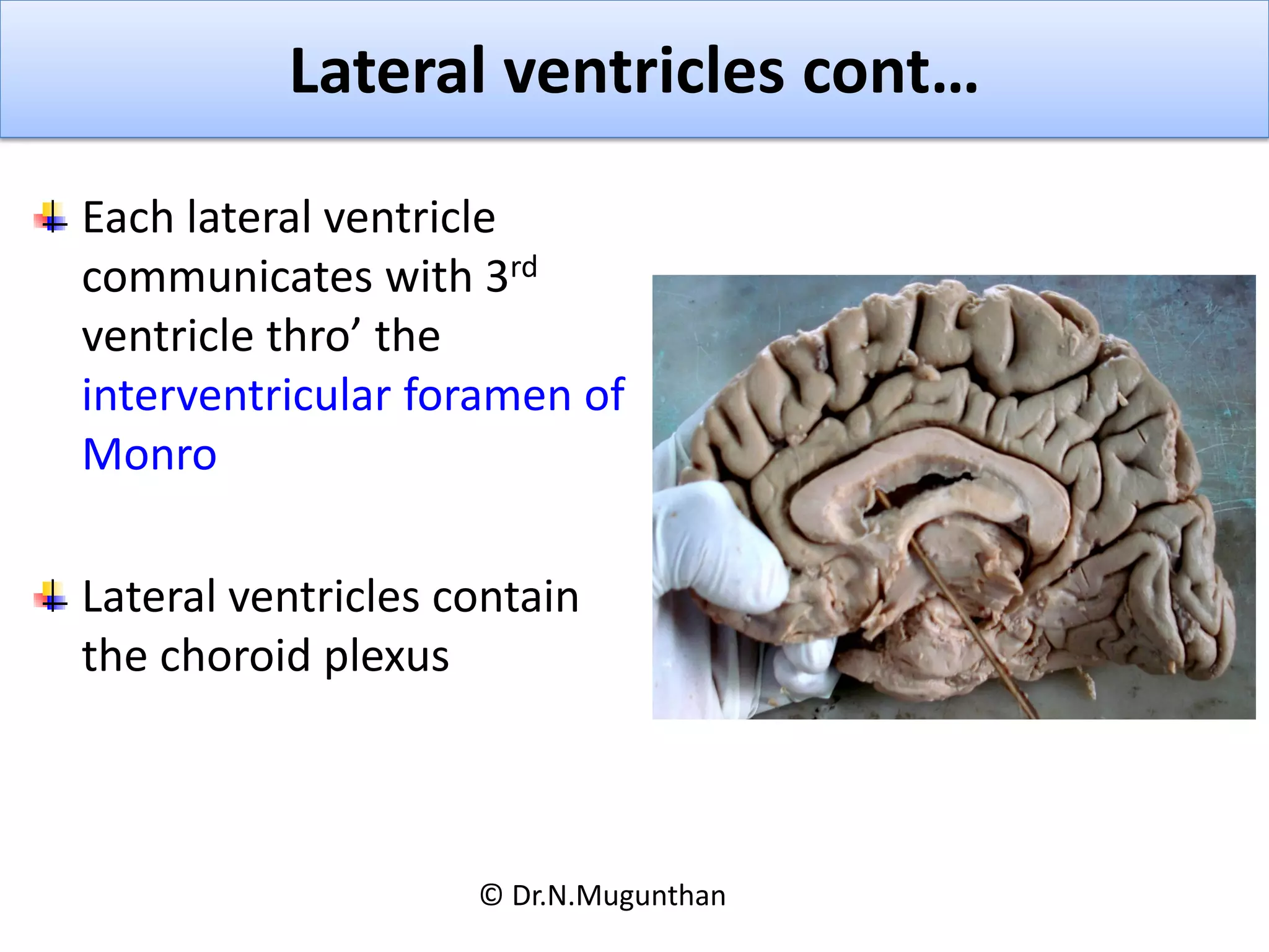 Lateral ventricle of Brain. By Dr.N.Mugunthan.M.S | PDF