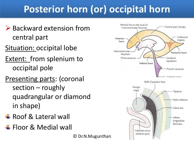 Lateral ventricle of Brain. By Dr.N.Mugunthan.M.S