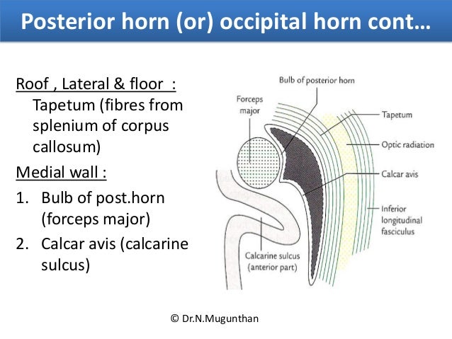 Lateral ventricle of Brain. By Dr.N.Mugunthan.M.S