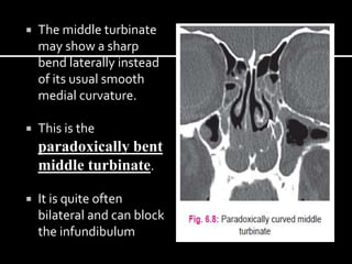 Anatomy of Lateral wall of nose | PPTX