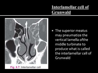 Anatomy of Lateral wall of nose | PPTX