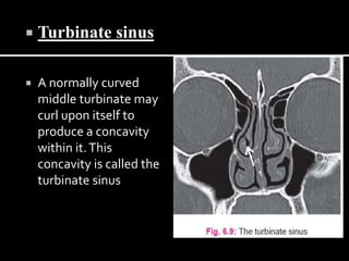 Anatomy of Lateral wall of nose | PPTX
