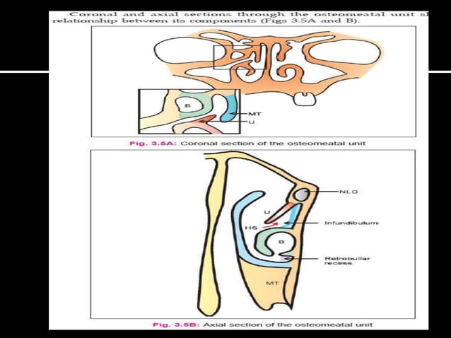 Anatomy of Lateral wall of nose | PPTX