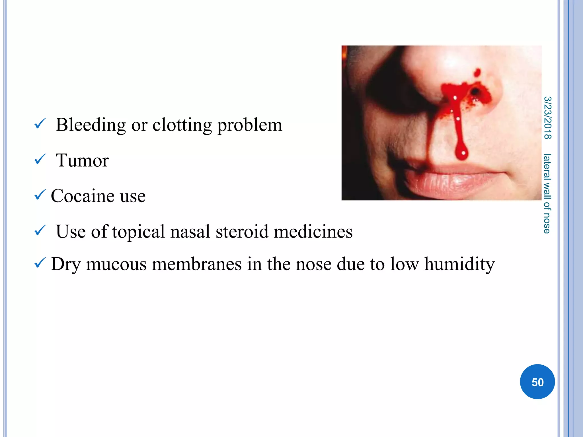 Lateral wall of nose | PPTX