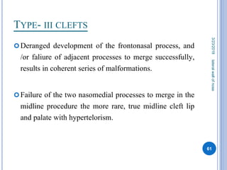 Lateral wall of nose | PPTX