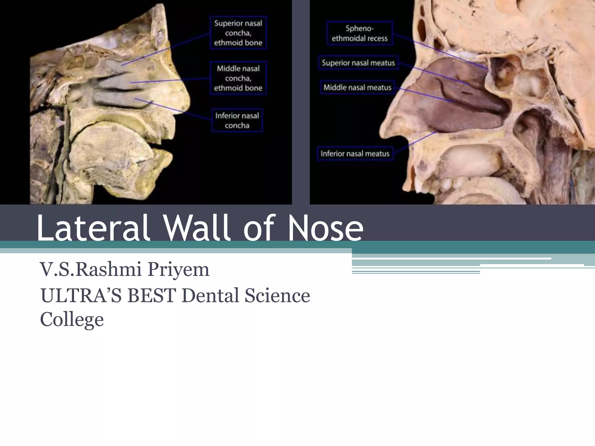 Lateral Wall of Nose | PPTX