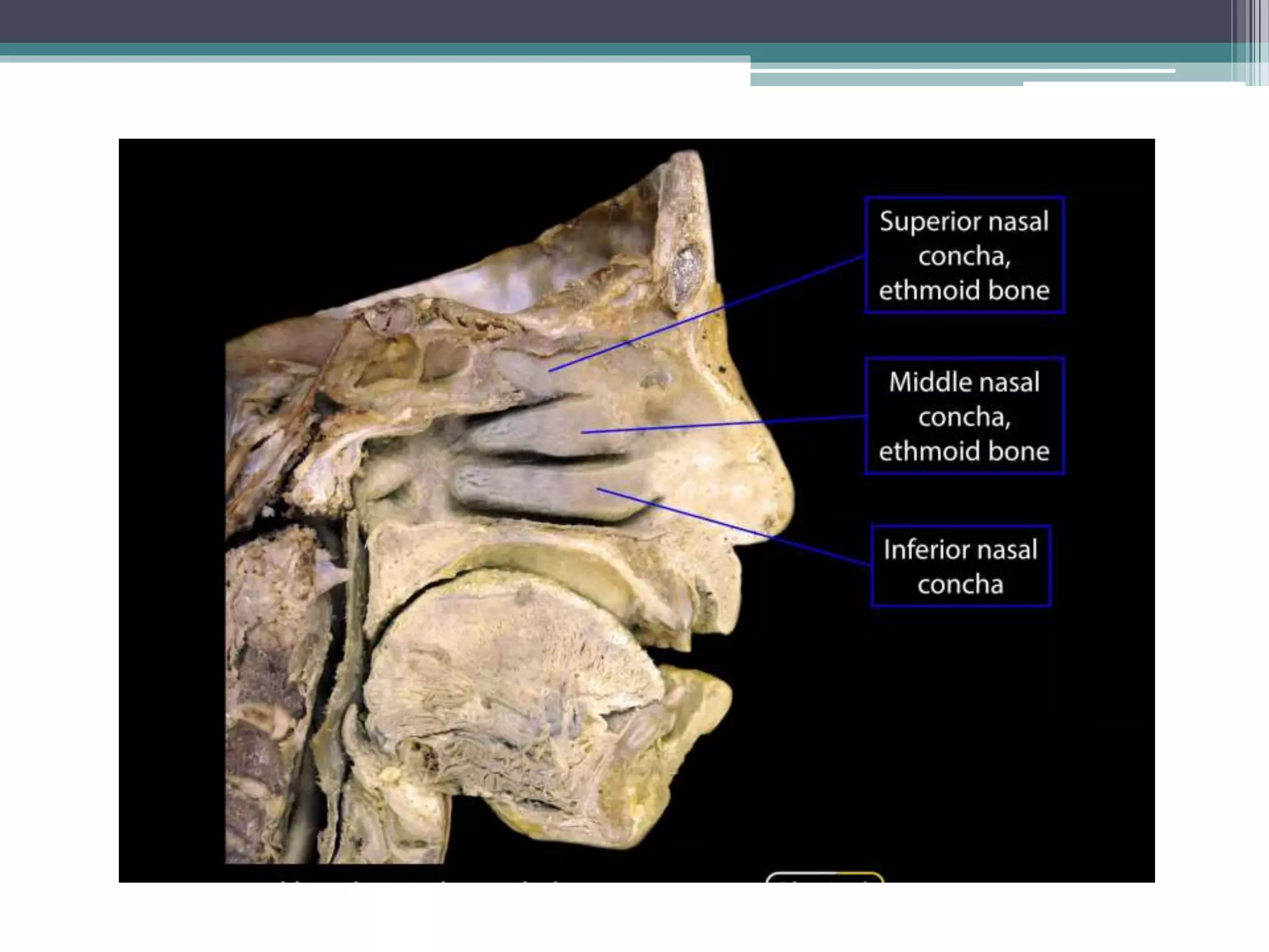 Lateral Wall of Nose | PPTX